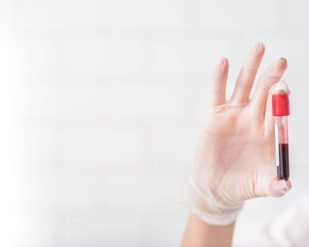 How Long Does Adderall Stay in Your System? | Elevate Recovery