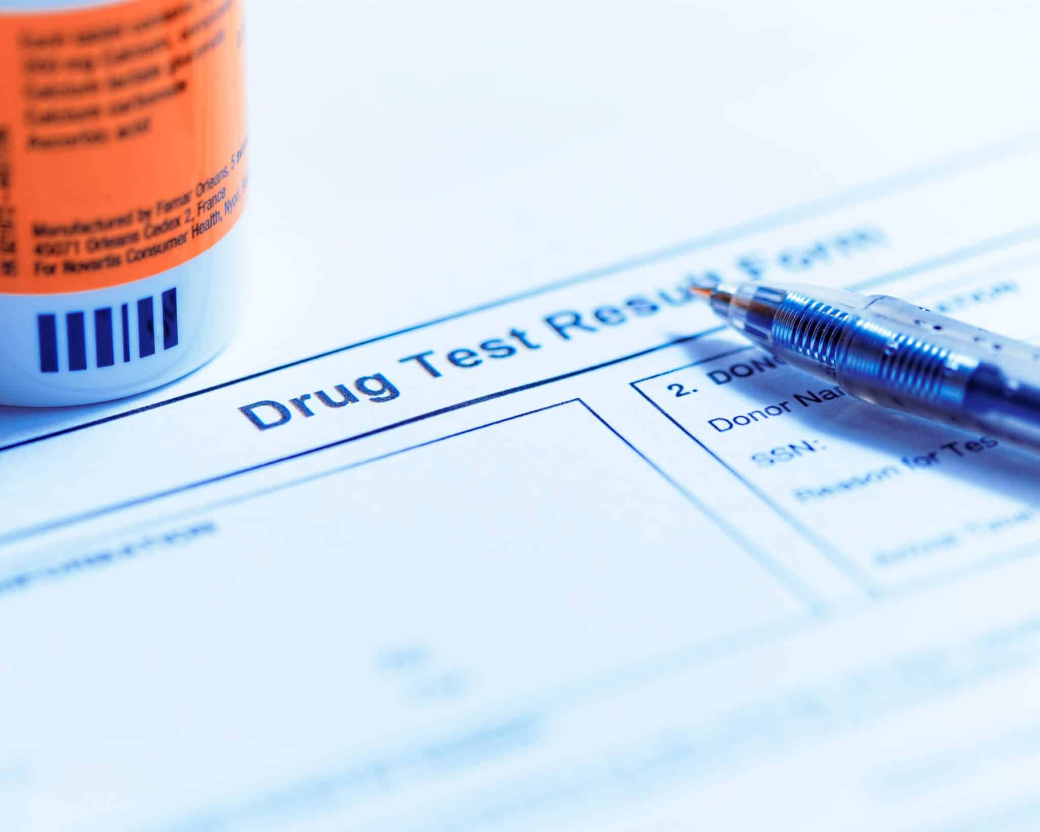 How to Pass a Drug Test: Tips and Strategies | Elevate Recovery
